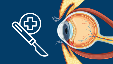 Diferencia entre enucleación y evisceración - prótesis oculares